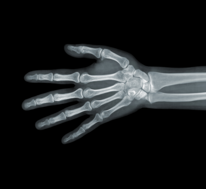 Technology | Trixell